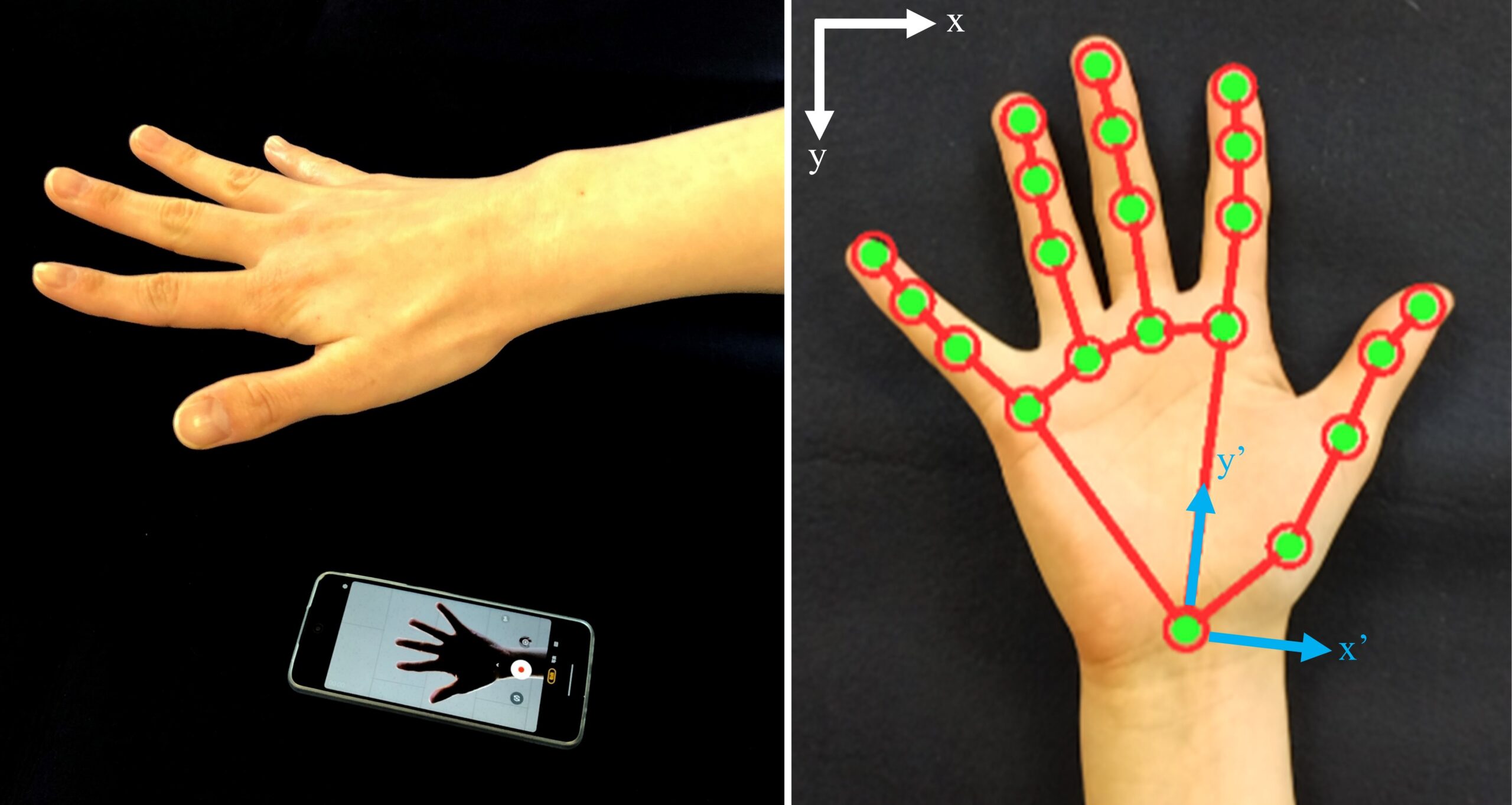 Diagnosis of carpal tunnel syndrome using a 10-s grip-and-release test ...